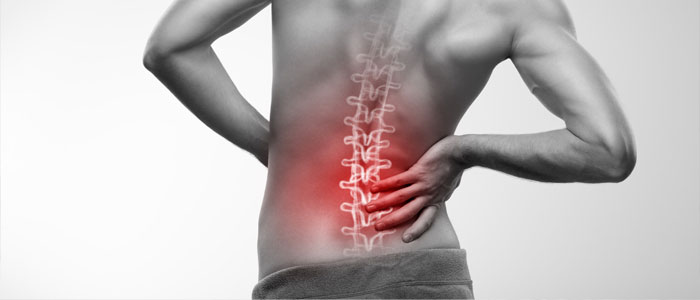 Mckenzie Method for Bulging or Herniated Disc | Colorado Springs CO